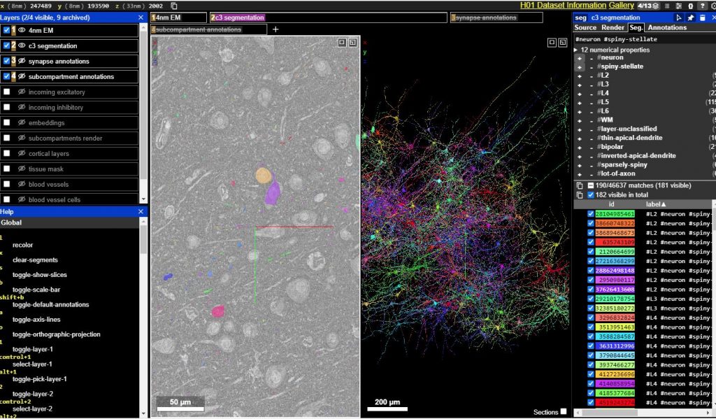 Como funciona: um mapa interativo que permite viajar pelo cérebro ...